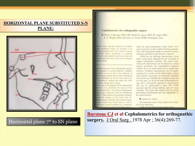 BURSTONE ANALYSIS : C.O.G.S ( HARD & SOFT TISSUE) | PPTX | Dental ...