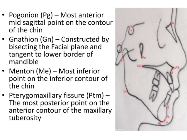 Burstone analysis | PPTX | Bone and Joint Conditions | Diseases and ...