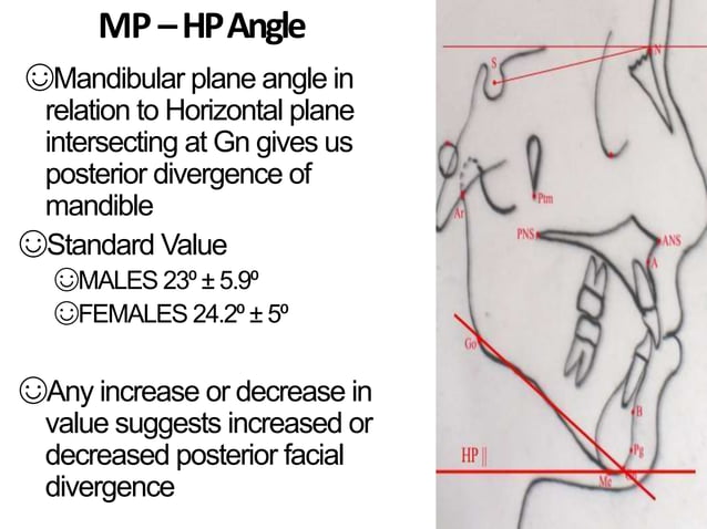 Burstone & Bjork.pptx