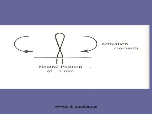 Burstone’s T Loop | PPT