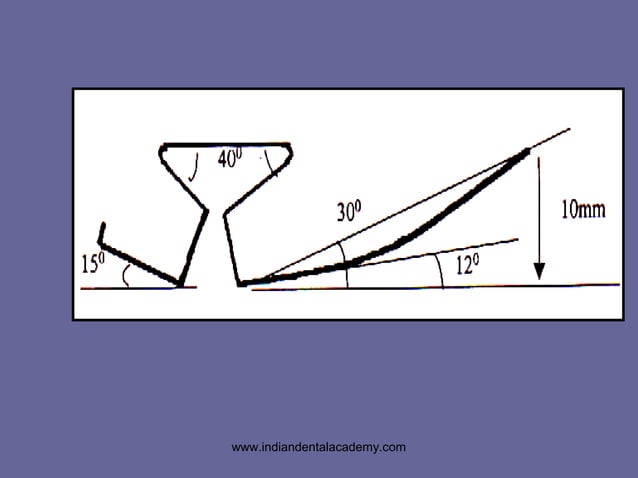 Burstone’s T Loop | PPT