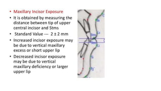 BURSTONE SOFT TISSUE ANALYSIS.pptx
