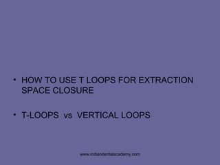 Burstone’s t loop | PPT