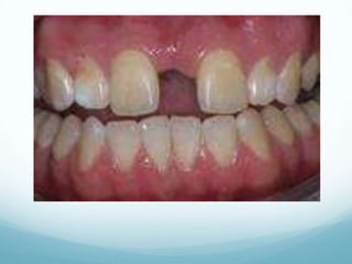 Behavior Change: Concepts and Models Ignite | PPTX