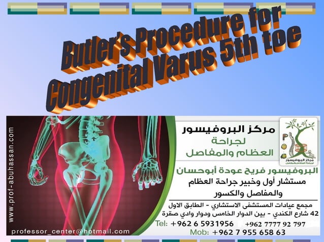Butler's procedure overriding 5th toe - البروفيسور فريح عوده ابوحسان | PPT