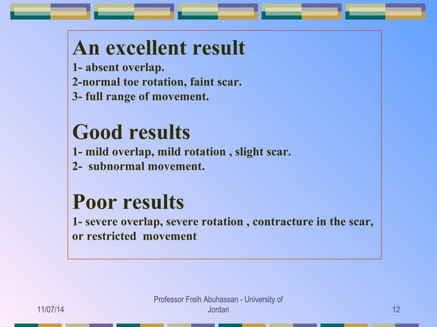 Butler's procedure overriding 5th toe - البروفيسور فريح عوده ابوحسان ...