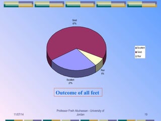 Butler's procedure overriding 5th toe - البروفيسور فريح عوده ابوحسان ...