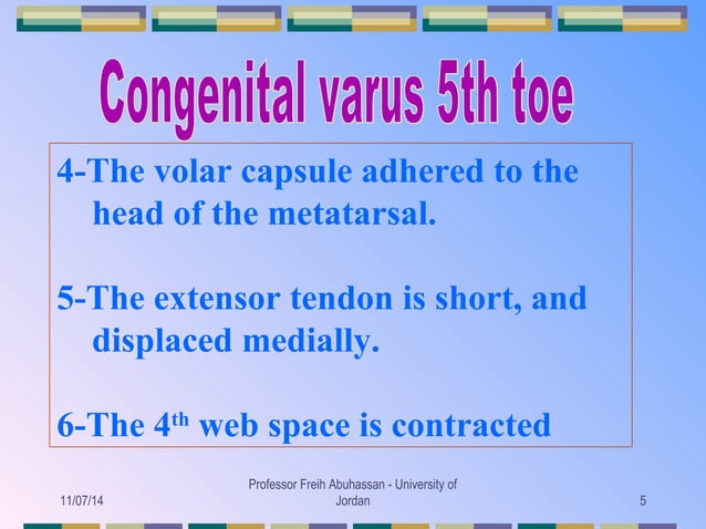 Butler's procedure overriding 5th toe - البروفيسور فريح عوده ابوحسان ...
