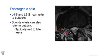 Buttockpainintheathlete | PPTX