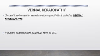 Vernal catarrh/ vernal keratoconjuctivitis | PPTX