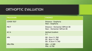 Divergence Insufficiency - Binocular Vision Anomaly | PPTX | Eye and ...