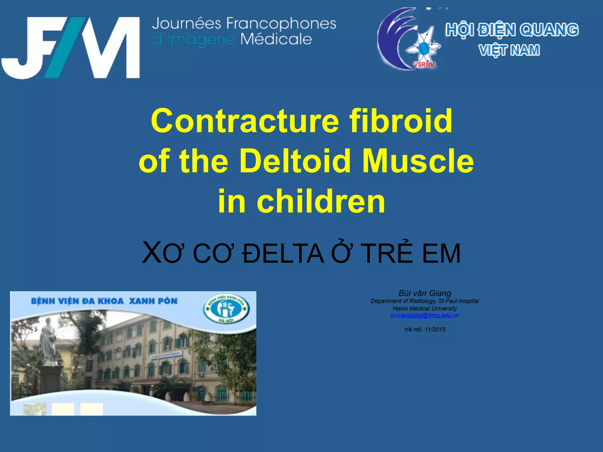 Bv giang contracture fibroid of the deltoid muscle in children jfim ...