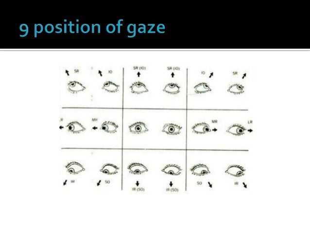 Binocular vision patient....what should I do?