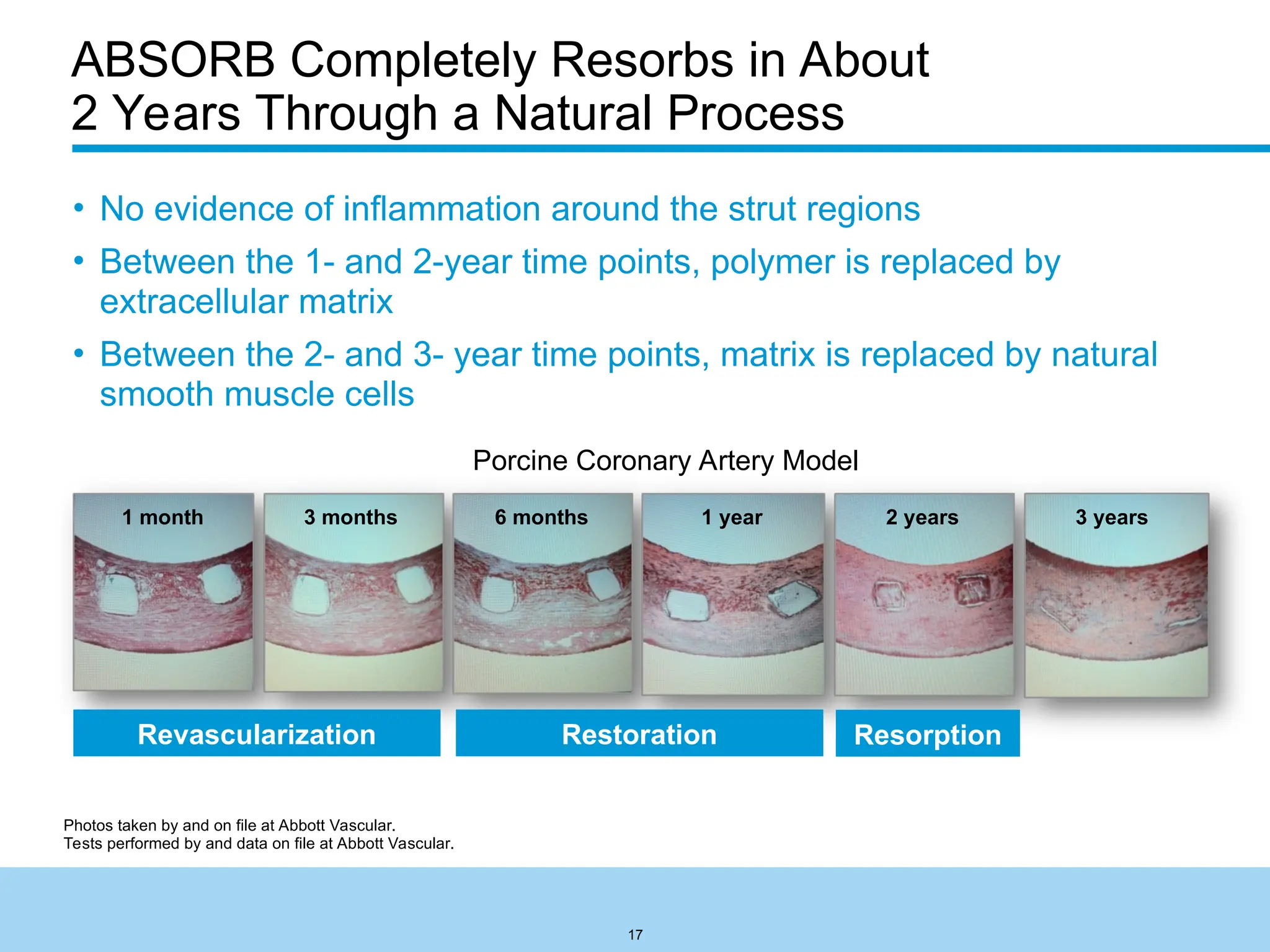 coronary stents: Biovascular scaffolds.. | PPT