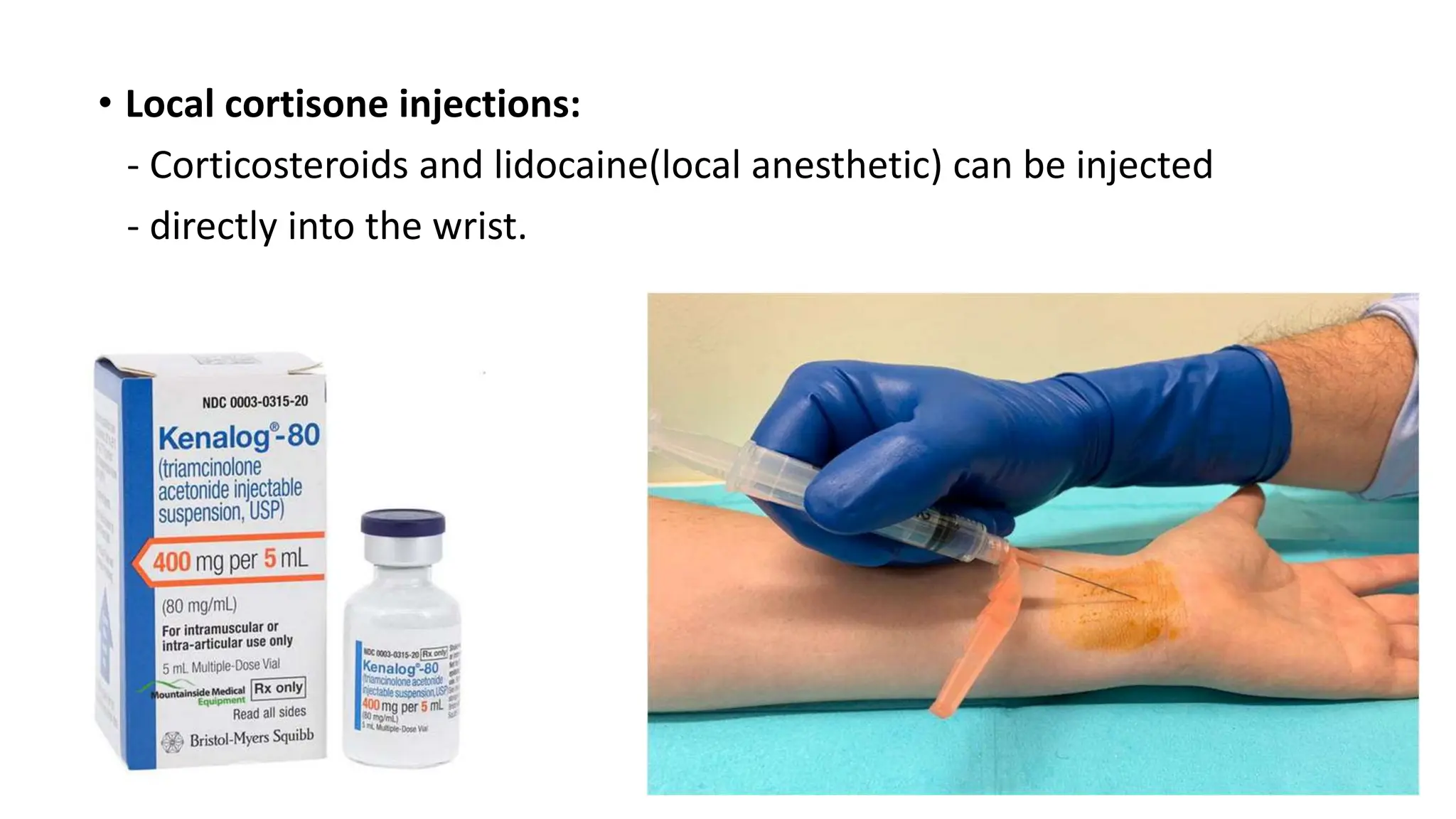 Carpal Tunnel Syndrome and Ganglion pptx | PPTX