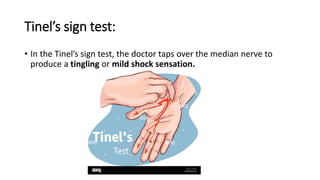 Carpal Tunnel Syndrome and Ganglion pptx | PPTX