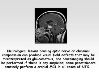 Black & White ! | PPT | Eye and Vision Conditions | Diseases and Conditions