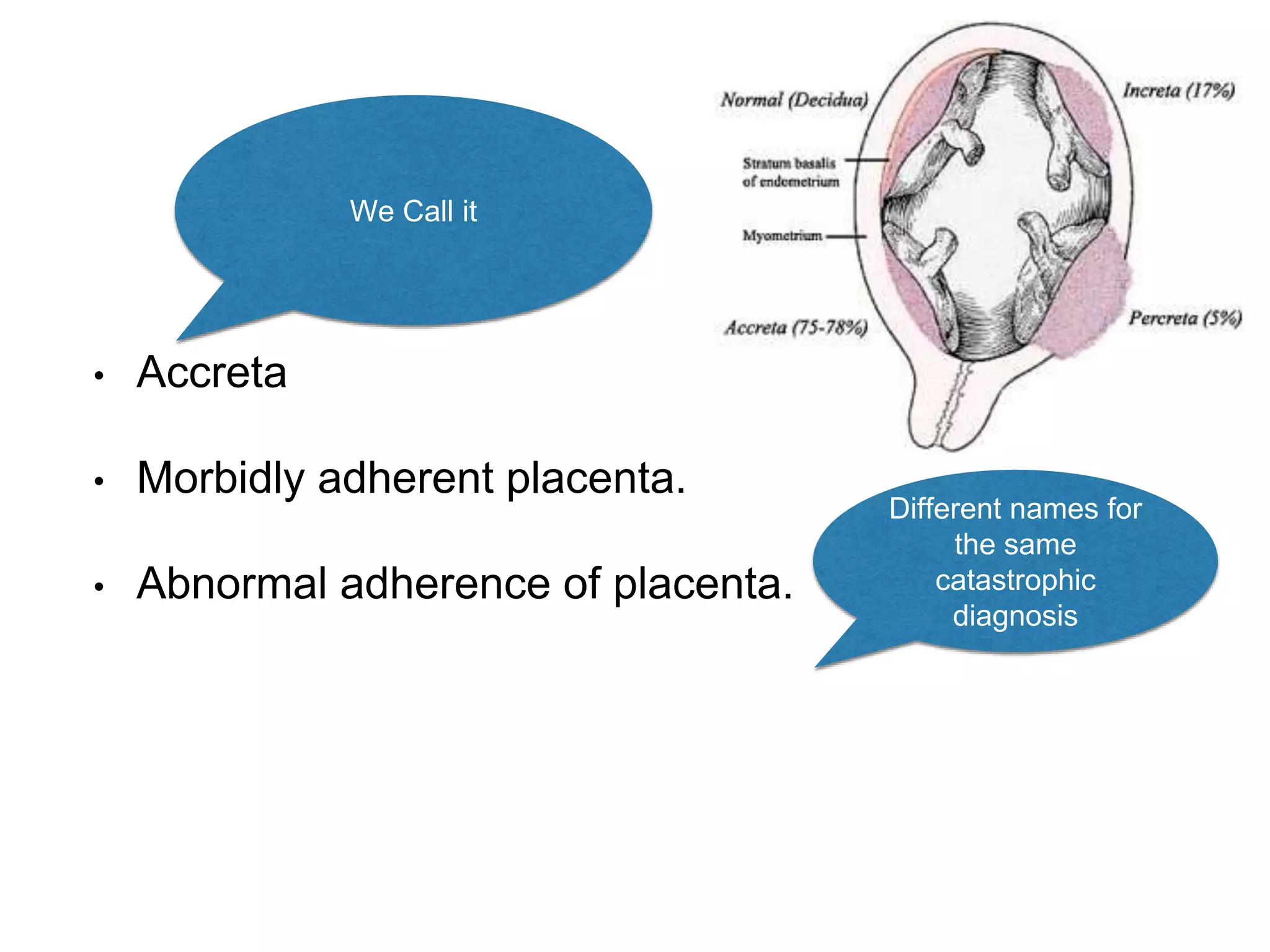 Placenta accreta | PPTX