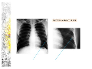 B wayang kulit | PPT