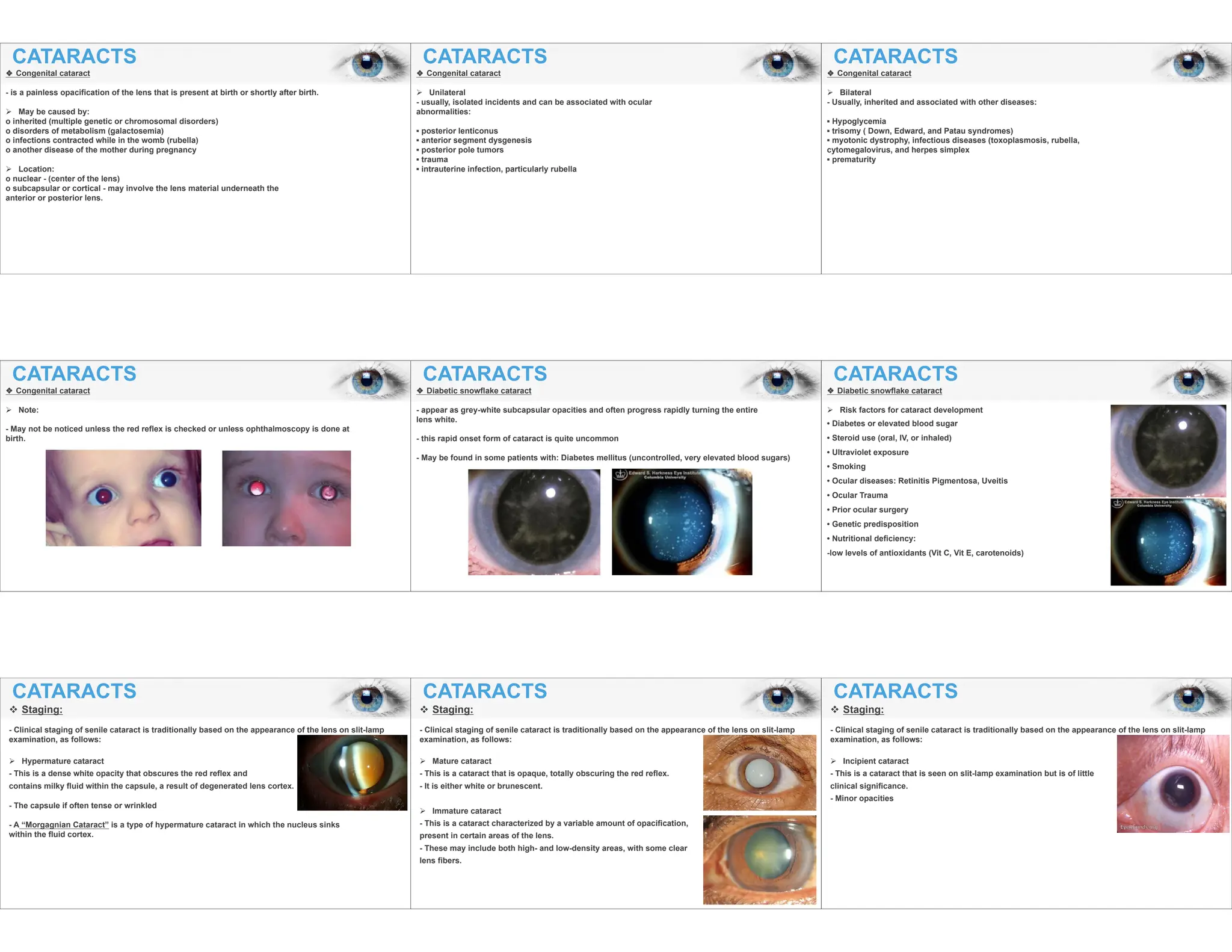Ocular Disease 2 CATARACT & Crystalline Lens | PDF