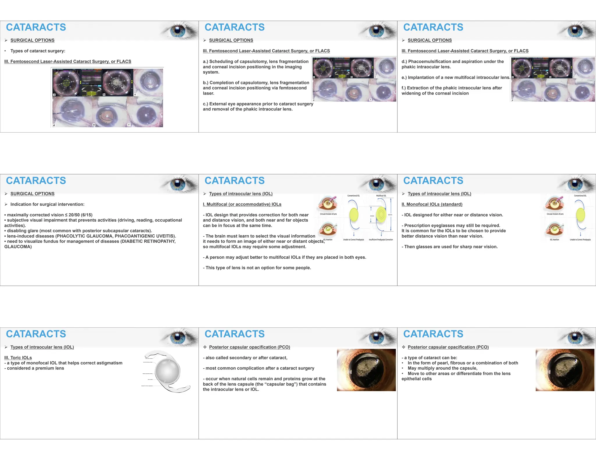 Ocular Disease 2 CATARACT & Crystalline Lens | PDF