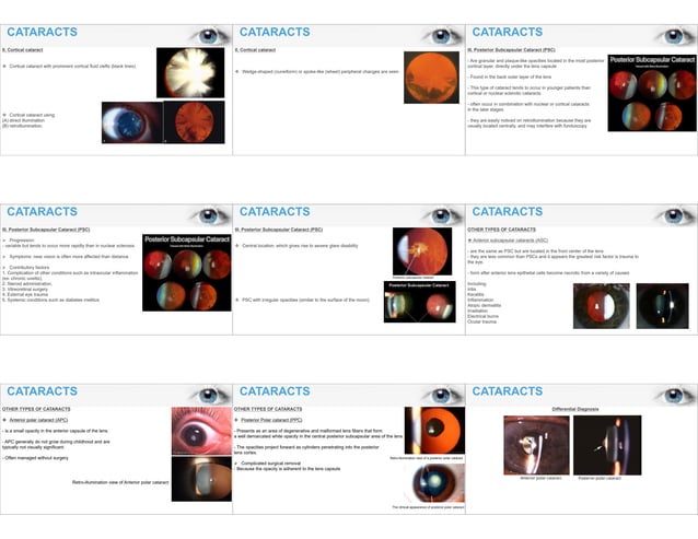 Ocular Disease 2 CATARACT & Crystalline Lens | PPT
