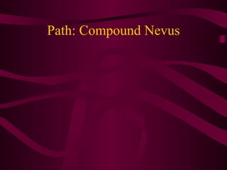 Malignant Melanoma | PPT