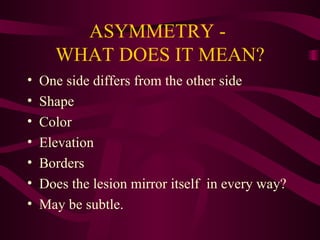 Malignant Melanoma | PPT
