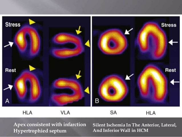 Bw's ch. 16 nuclear cardiology part 4