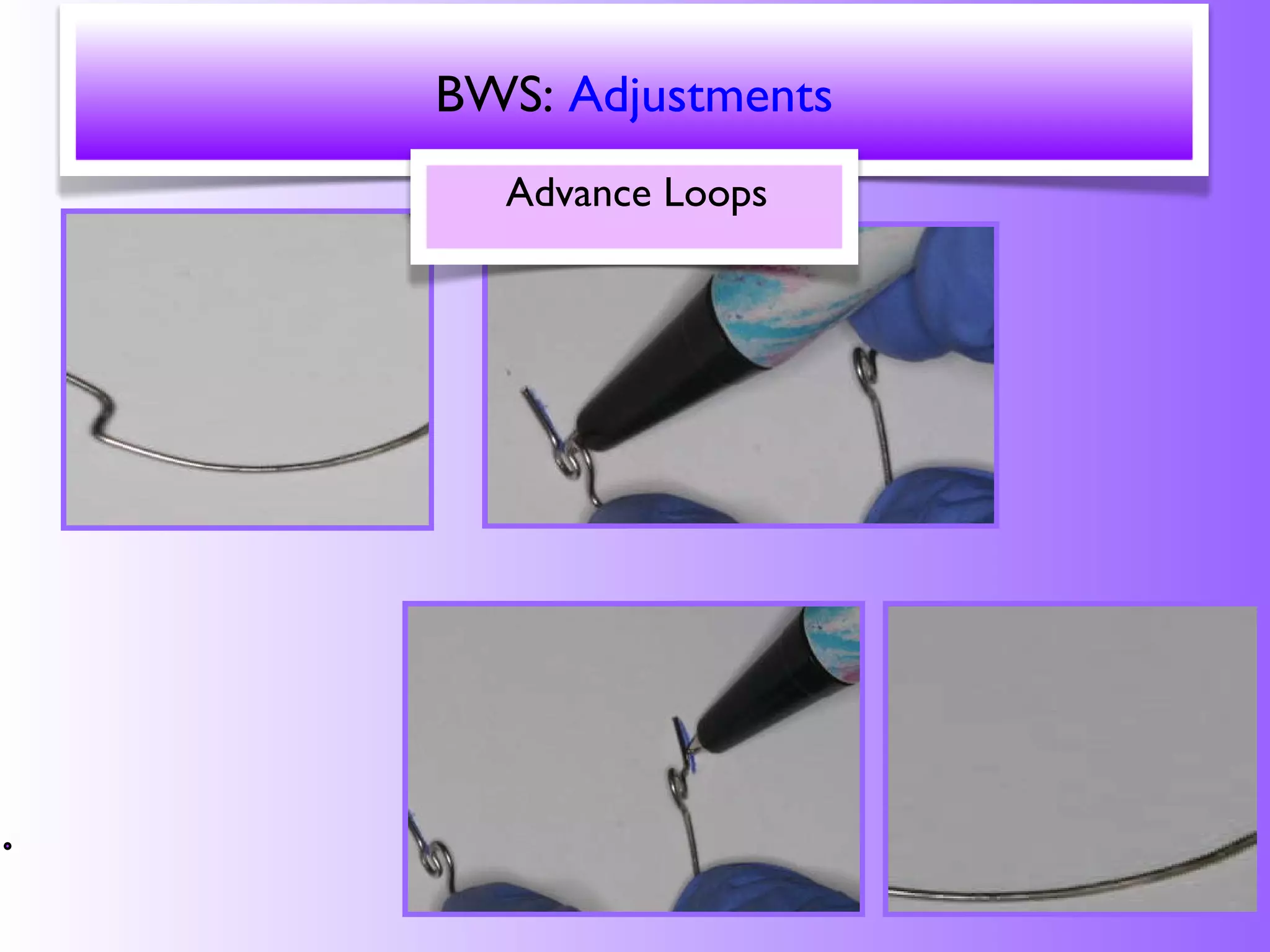 BWS placement and adjustment | PPT