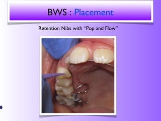 BWS placement and adjustment | PPT