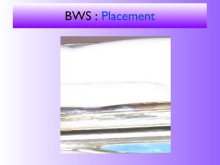 BWS placement and adjustment | PPT