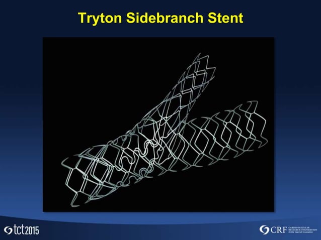 Tryton - Addressing the Challenge of Bifurcation Stenting | Dean J ...