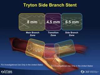 Tryton - Addressing the Challenge of Bifurcation Stenting | Dean J. Kereiakes, M.D. | PPTX ...