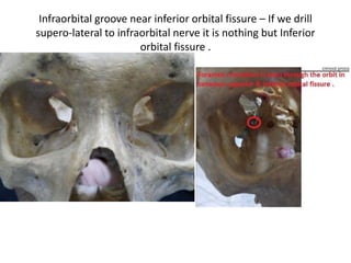 Infraorbital Groove