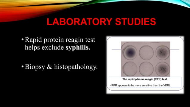 Balanitis Xerotica Obliterans / BXO / Penile Lichen Sclerosis | PPTX ...