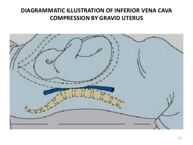 Blood pressure & Its Prosthodontic Implication