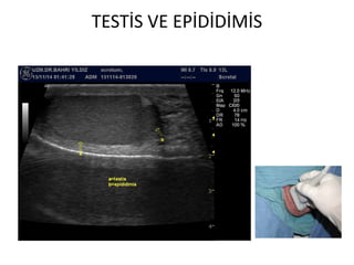 prostat ultrasonografisi | PPT