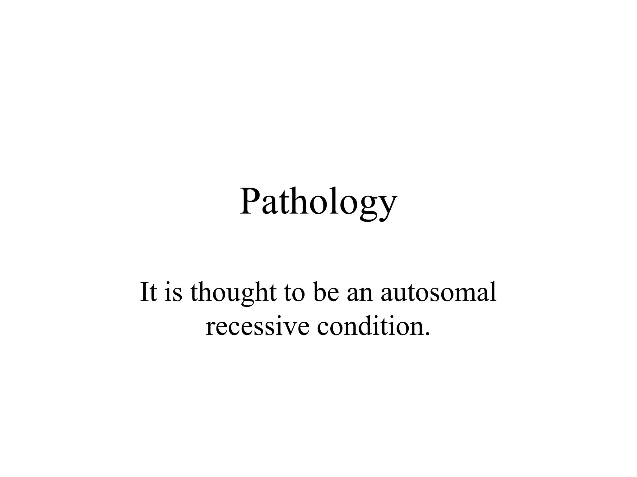 By dr. vijay sharma asphyxiating thoracic dysplasia (jeune syndrome ...