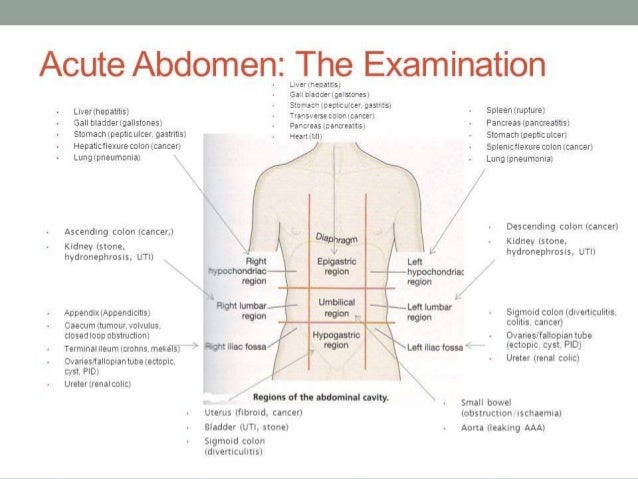 ACUTE ABDOMEN