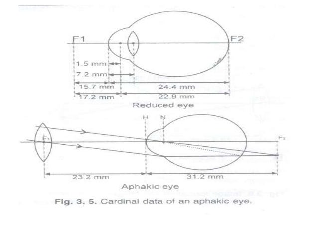 By pd aphakia & pseudophakia