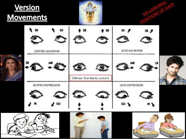 By pd examination of a squint