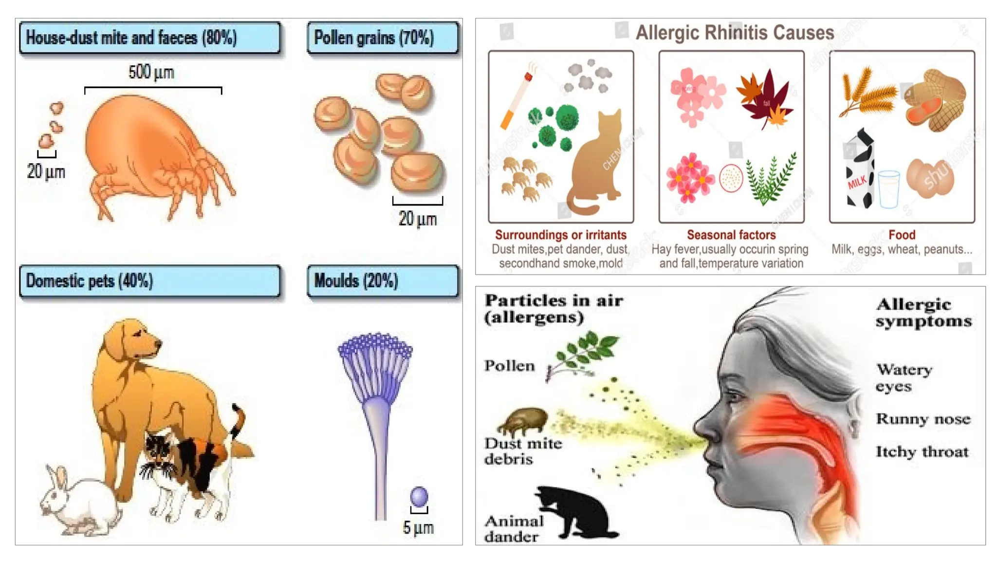 presentation of allergic rhinitis by puja | PPTX