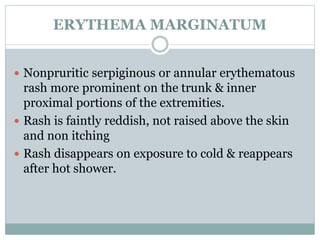 Acute rheumatic fever | PPTX