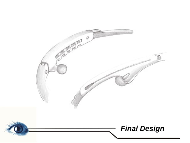 Meniscus, the Eye Diagnostic Integrated Facility | PPT