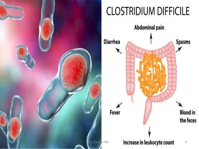 Clostridium difficile by Dr.T.V.Rao MD