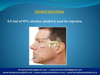 Trigeminal Neuralgia| Management of Facial Pain | PPTX