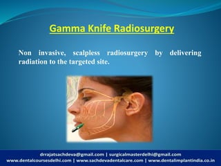 Trigeminal Neuralgia| Management of Facial Pain | PPTX