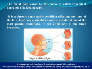 Trigeminal Neuralgia| Management of Facial Pain | PPTX