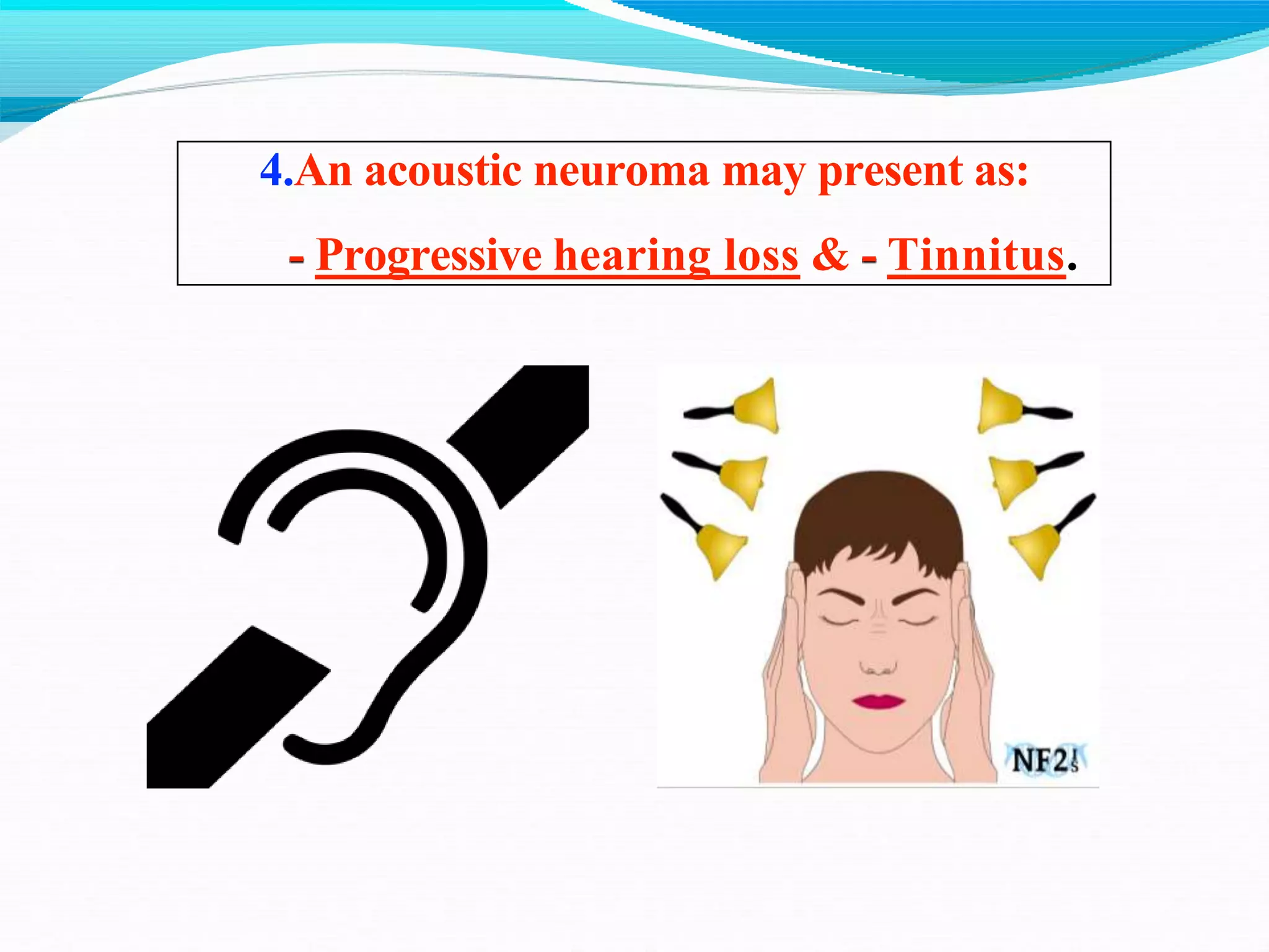 Clinical Pictures of Brain tumor (neuroma) | PPSX